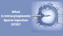What is Intracytoplasmic Sperm Injection (ICSI)?